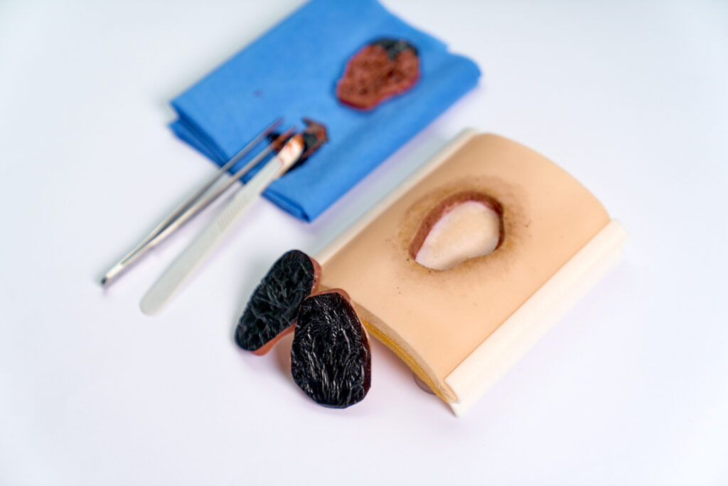 Skin pad with pressure ulcer - Plan3D